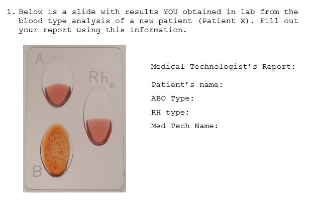Solved 1. Below is a slide with results You obtained in lab | Chegg.com