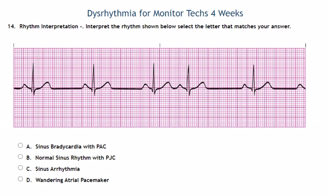 Solved Dysrhythmia for Monitor Techs 4 Weeks 14. Rhythm | Chegg.com