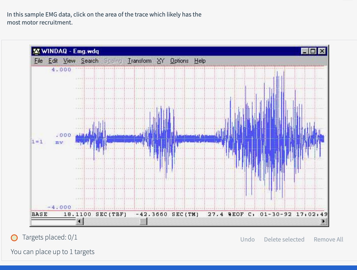 Solved In this sample EMG data, click on the area of the | Chegg.com