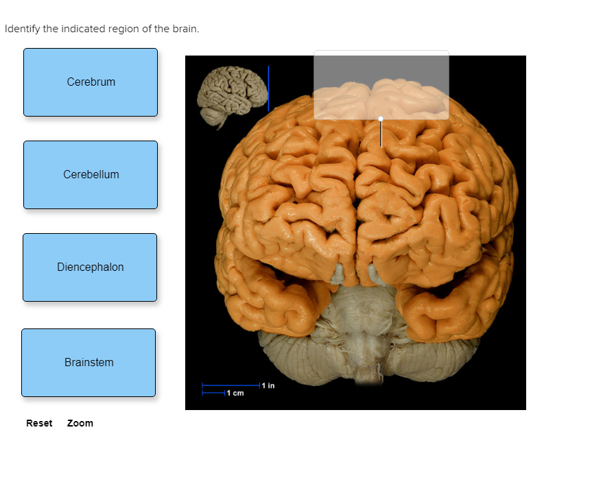 Part Of Brain Insula