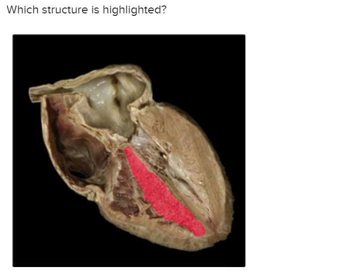 Solved what is the structure highlighted ??trabeculae | Chegg.com