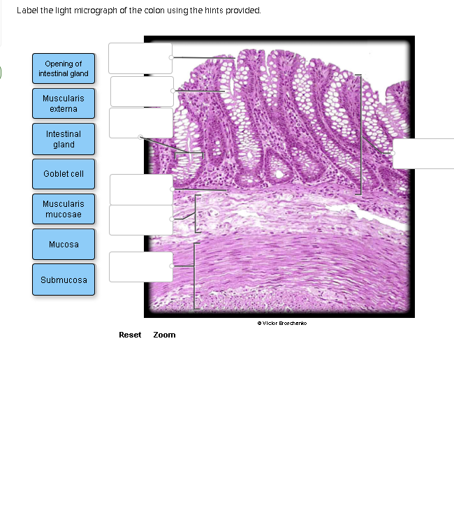 Solved Label the light micrograph of the colon using the | Chegg.com