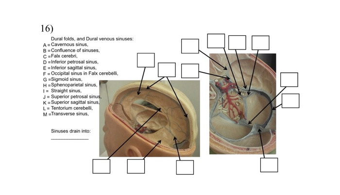 Solved 16) Dural folds, and Dural venous sinuses: A. | Chegg.com