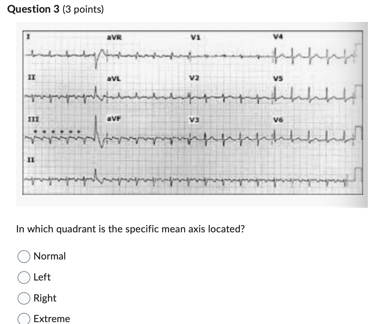 In which quadrant is the specific mean axis | Chegg.com