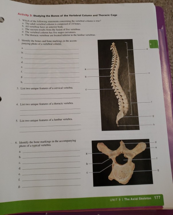 Solved Activity 3: Studying the Bones of the Vertebral | Chegg.com