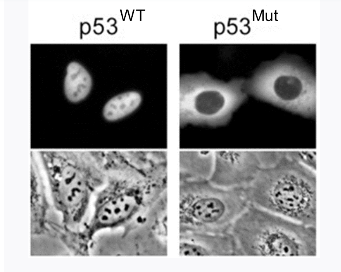 Solved Mutations of the transcription factor p53 are linked | Chegg.com