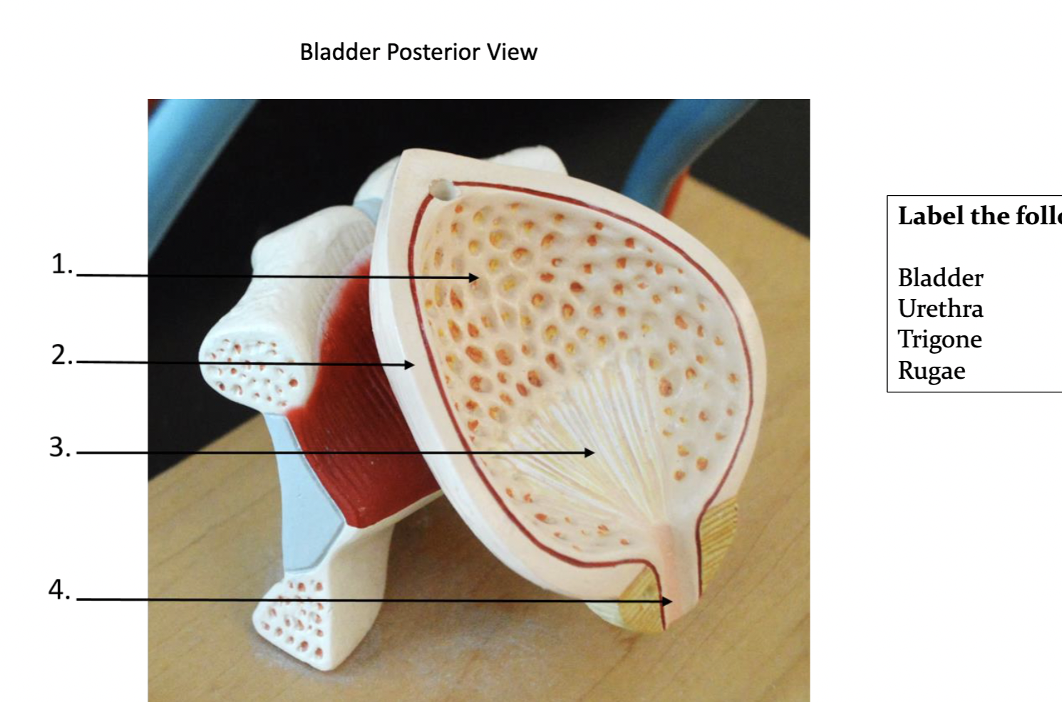 Solved Kidney Lateral View Vidnn, Crontal Dlonn I atoml | Chegg.com