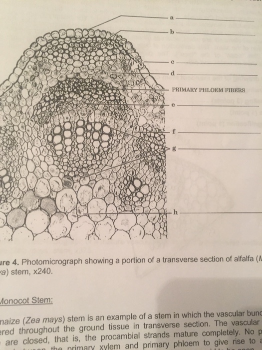 Solved PRIMARY PHLOEM FIBERS re 4, Photomicrograph showing a | Chegg.com