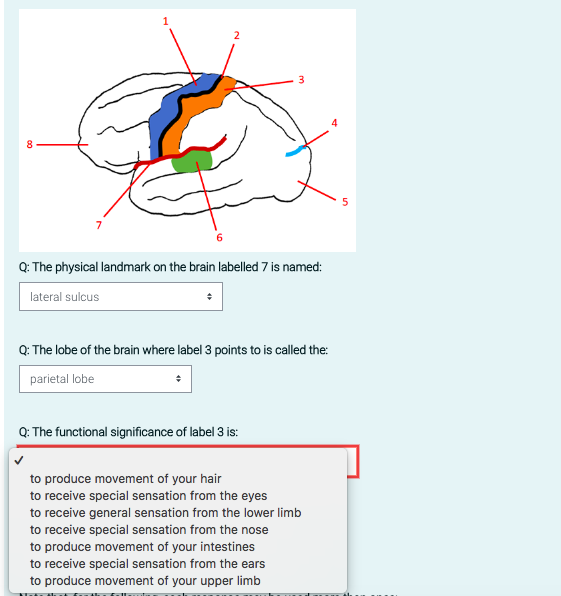 Q: The physical landmark on the brain labelled 7 is | Chegg.com