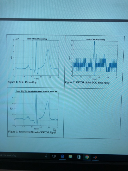 Encode the ECG Lead II signal using DPCM then recover | Chegg.com