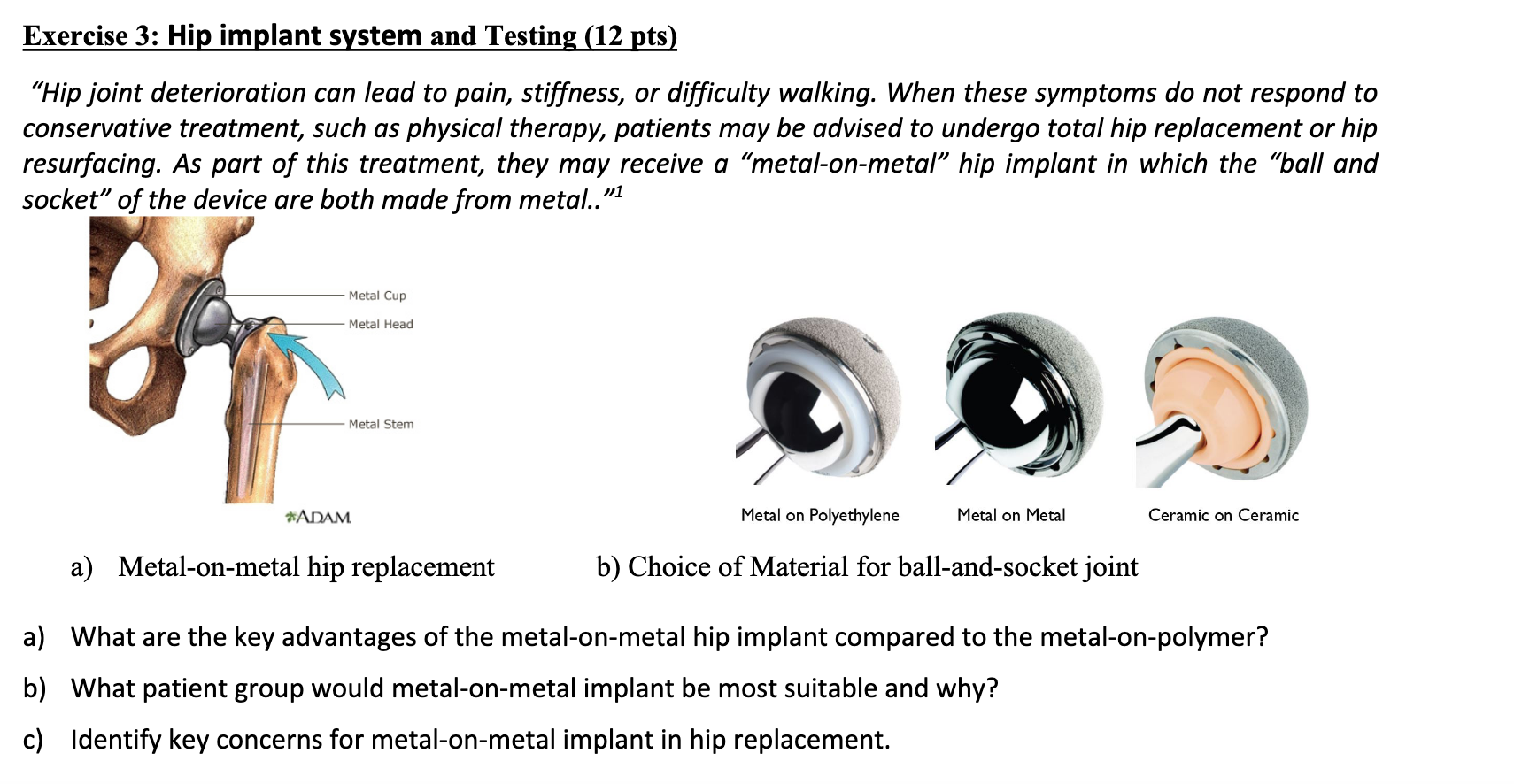 Solved Exercise 3: Hip implant system and Testing (12 pts) | Chegg.com