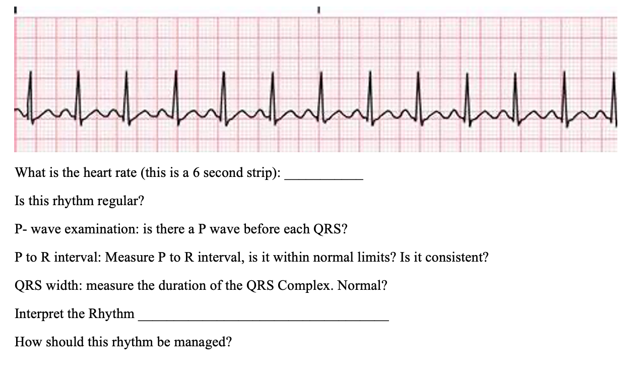 What is the heart rate (this is a 6 ﻿second strip):Is | Chegg.com