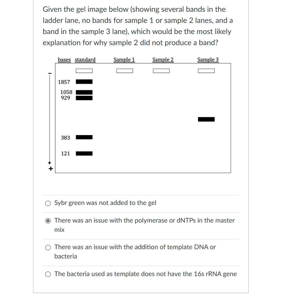 Solved Given the gel image below (showing several bands in | Chegg.com