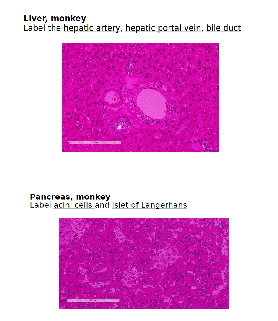 Solved Liver, monkey Label the hepatic artery, hepatic | Chegg.com