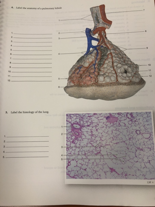 Solved Label the anatomy of a pulmonary lobule. | Chegg.com