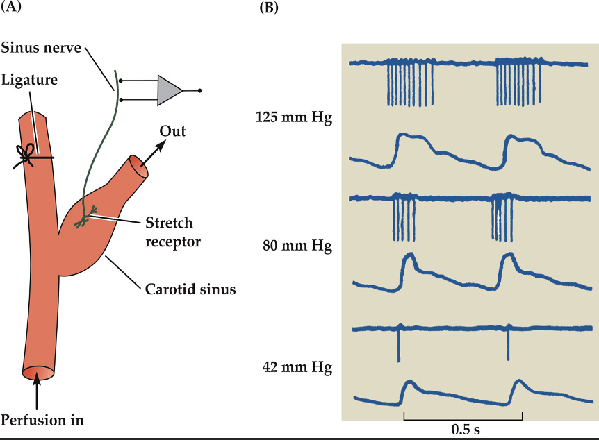Solved Describe results of the stretch receptor/action | Chegg.com