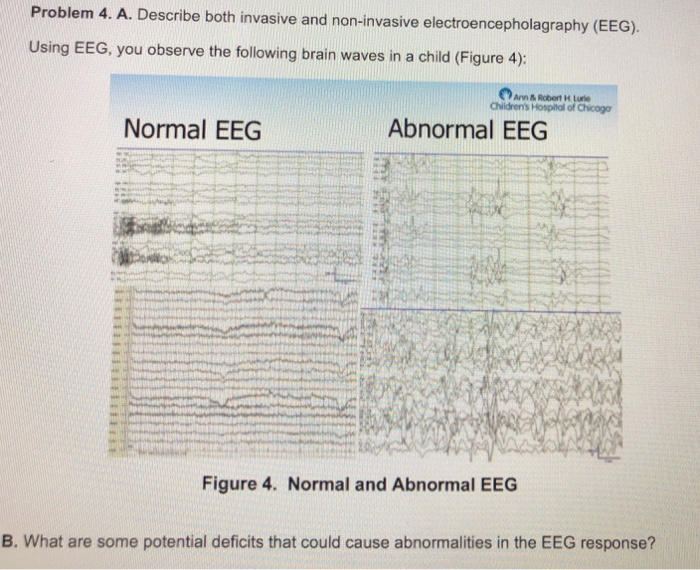 Normal Eeg Vs Abnormal Eeg