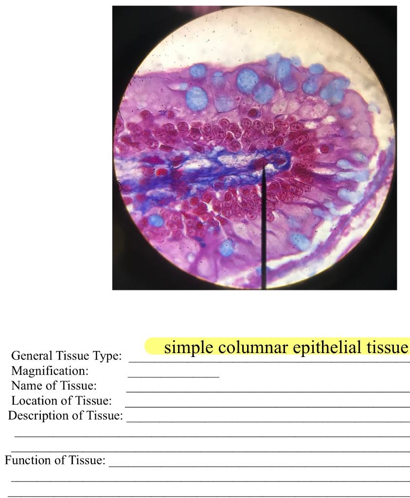 Solved simple columnar epithelial tissue General Tissue | Chegg.com