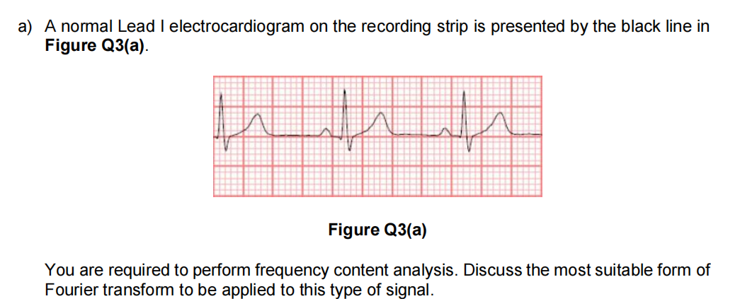 Solved a) A normal Lead I electrocardiogram on the recording | Chegg.com