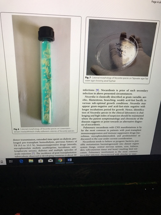 Solved Fig.4 Colonial morphology of Nocardia species on | Chegg.com