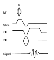 Solved MRI Q4 Below is a Gradient-Echo Pulse Sequence | Chegg.com