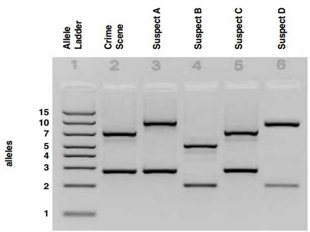 Solved Can you provide an analysis of this gel based on | Chegg.com