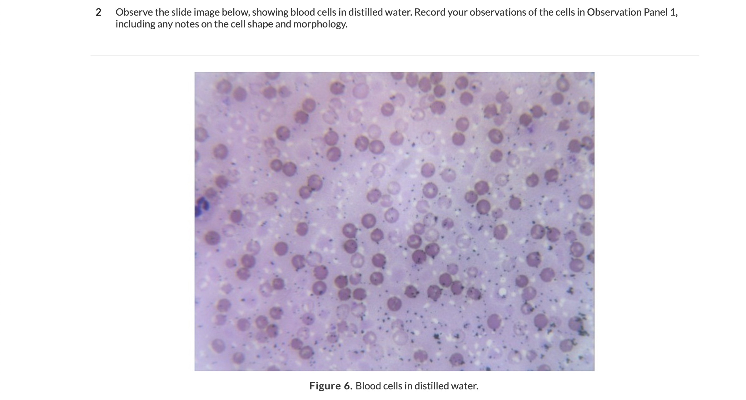 Solved 2 Observe the slide image below, showing blood cells | Chegg.com