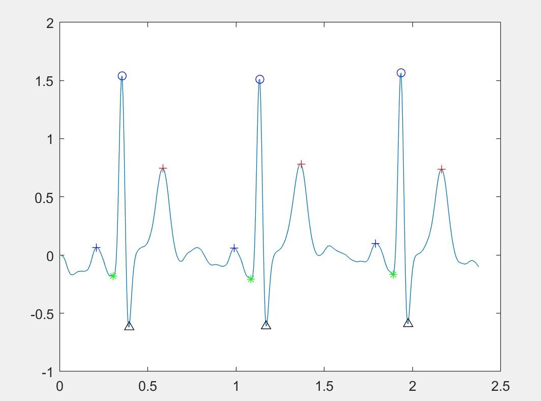 Solved How can i convert that code to draw for me animated | Chegg.com