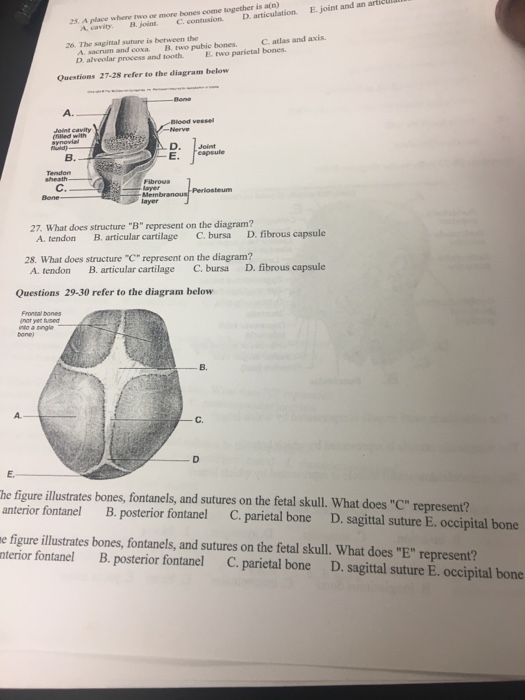 Solved What Does Structure B Represent On The Diagram Chegg