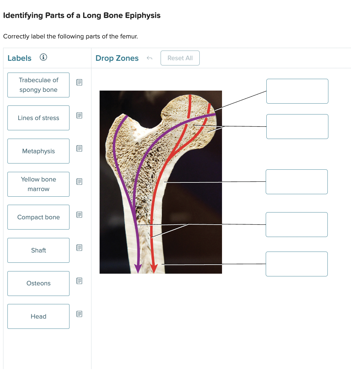 Solved Identifying Parts of a Long Bone EpiphysisCorrectly | Chegg.com