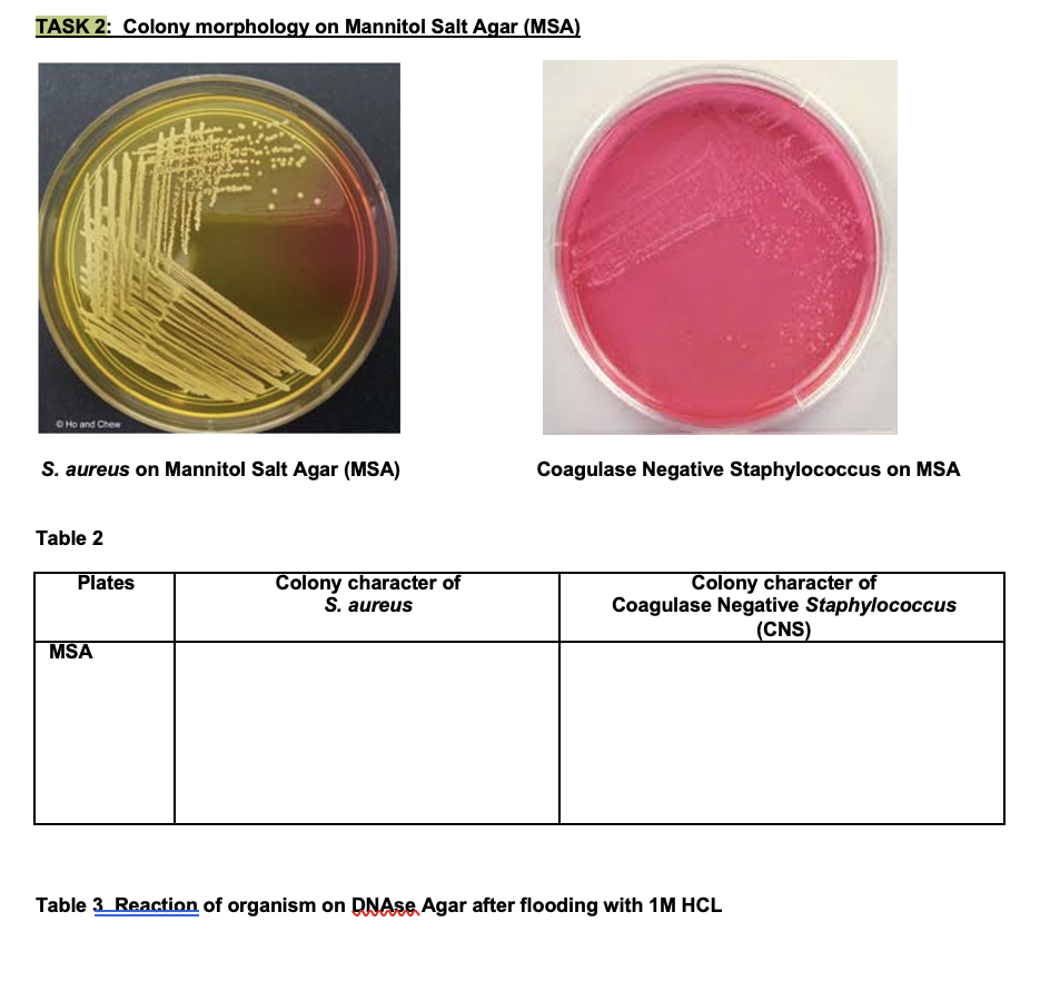 Solved TASK 2 You are provided with 2 types of media plates | Chegg.com