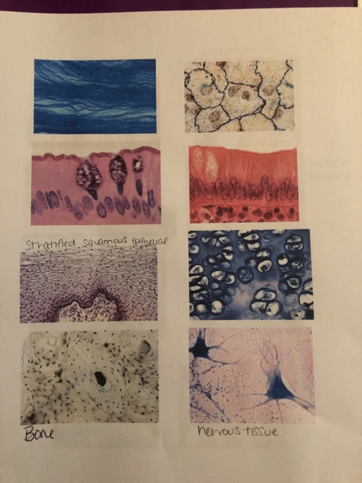 Solved Label the microscope slides | Chegg.com