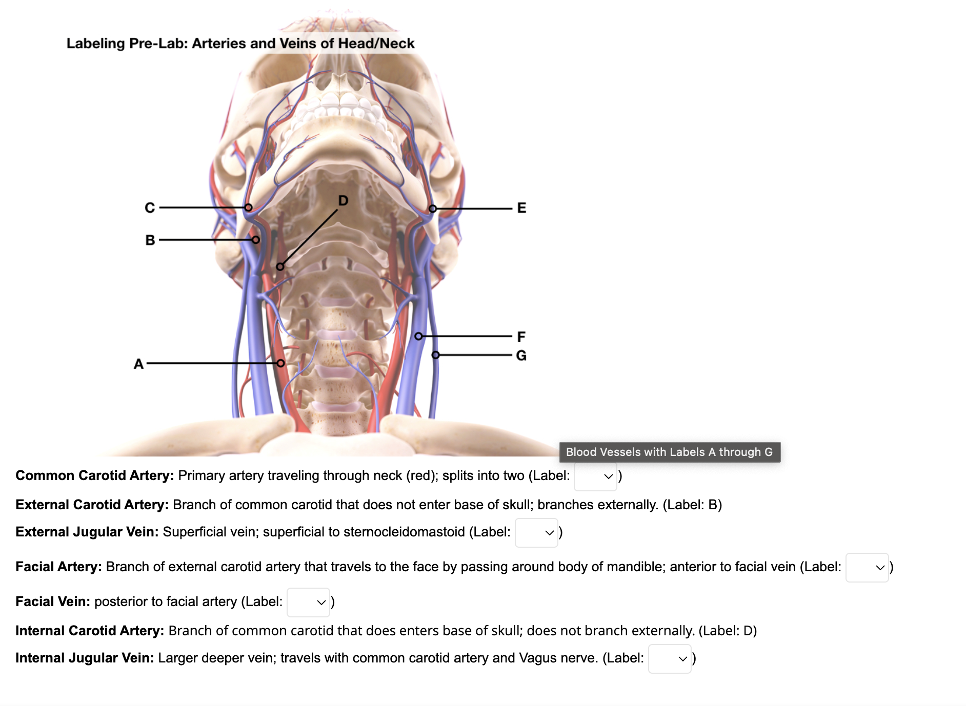 Solved Labeling Pre-Lab: Arteries and Veins of Head/Neck | Chegg.com