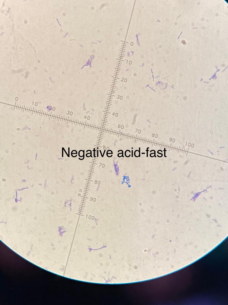 Solved 1 Negative acid-fast Positive for | Chegg.com
