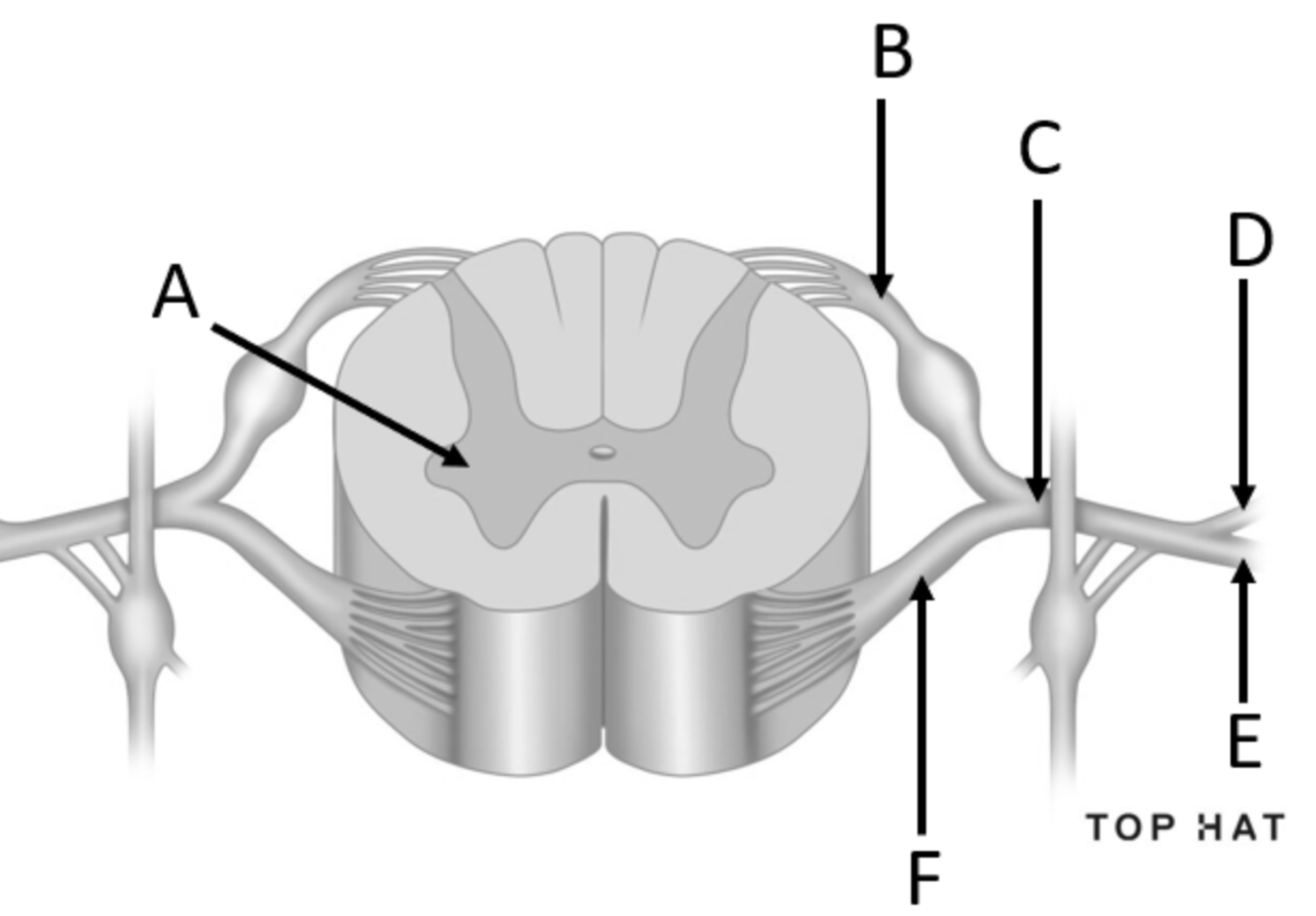 Solved A patient presents with weakness in the muscles of | Chegg.com