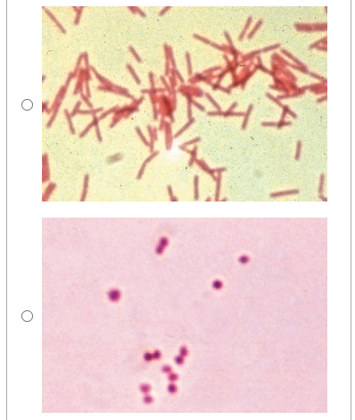 Solved Microbiology - Clinical Microbiology and Rapid | Chegg.com