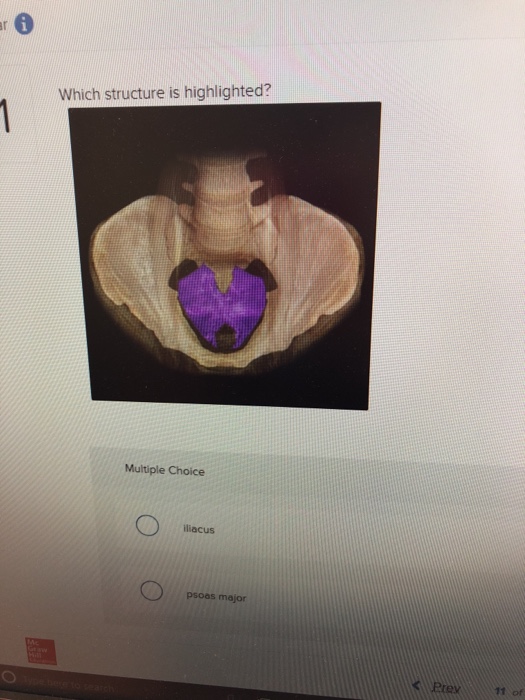Solved Which structure is highlighted? Multiple Choice | Chegg.com
