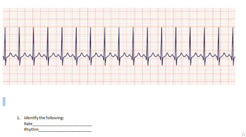 Solved 1. Identify the following: Rate Rhythm А. | Chegg.com