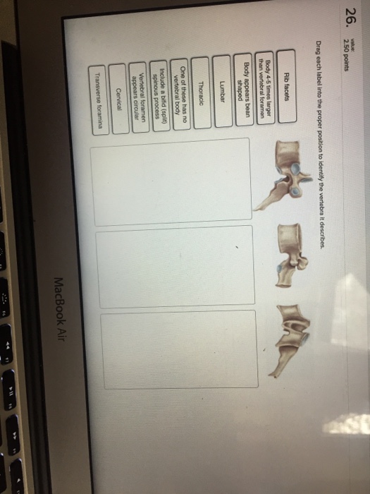 Solved Drag each label into the proper position to identify | Chegg.com