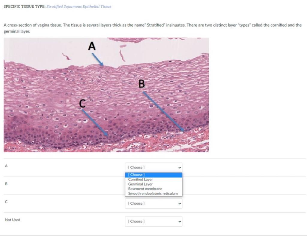 Solved SPECIFIC TISSUE TYPE: Stratified Squamous Epithelial | Chegg.com