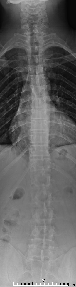 I need a Python program to implement Convolutional | Chegg.com