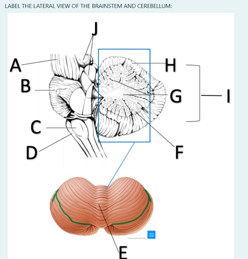 Solved LABEL THE LATERAL VIEW OF THE BRAINSTEM AND | Chegg.com