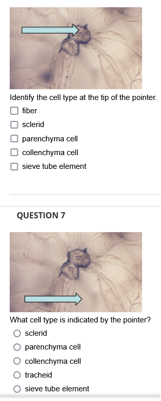 Solved Identify the cell type at the tip of the pointer. | Chegg.com