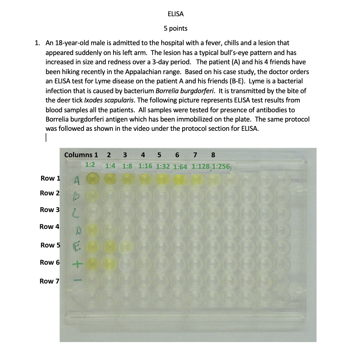 Solved ELISA 5 points 1. An 18-year-old male is admitted to | Chegg.com