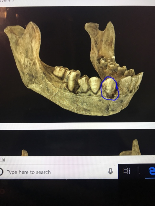 Solved Dental Formula of 2:1:2:2 (3d molar not erupted) | Chegg.com