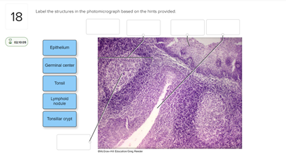 Solved 18 Label the structures in the photomicrograph based | Chegg.com