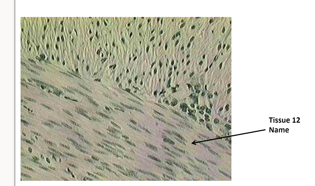 Solved Tissue 12 | Chegg.com