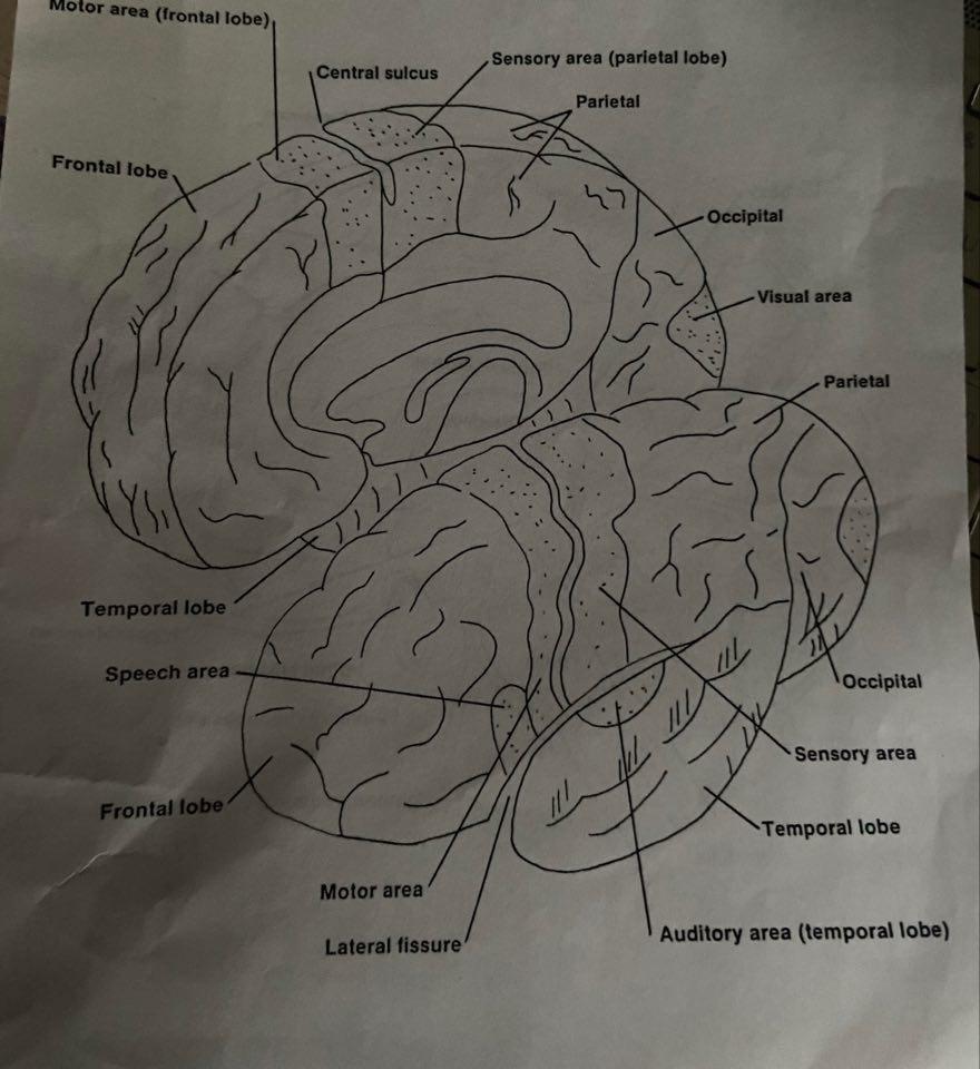 Solved Motor area (frontal lobe) Sensory area (parietal | Chegg.com