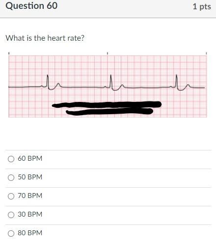 Solved Question 58 What is the heart rate? 1 pts بل للسلسل O | Chegg.com