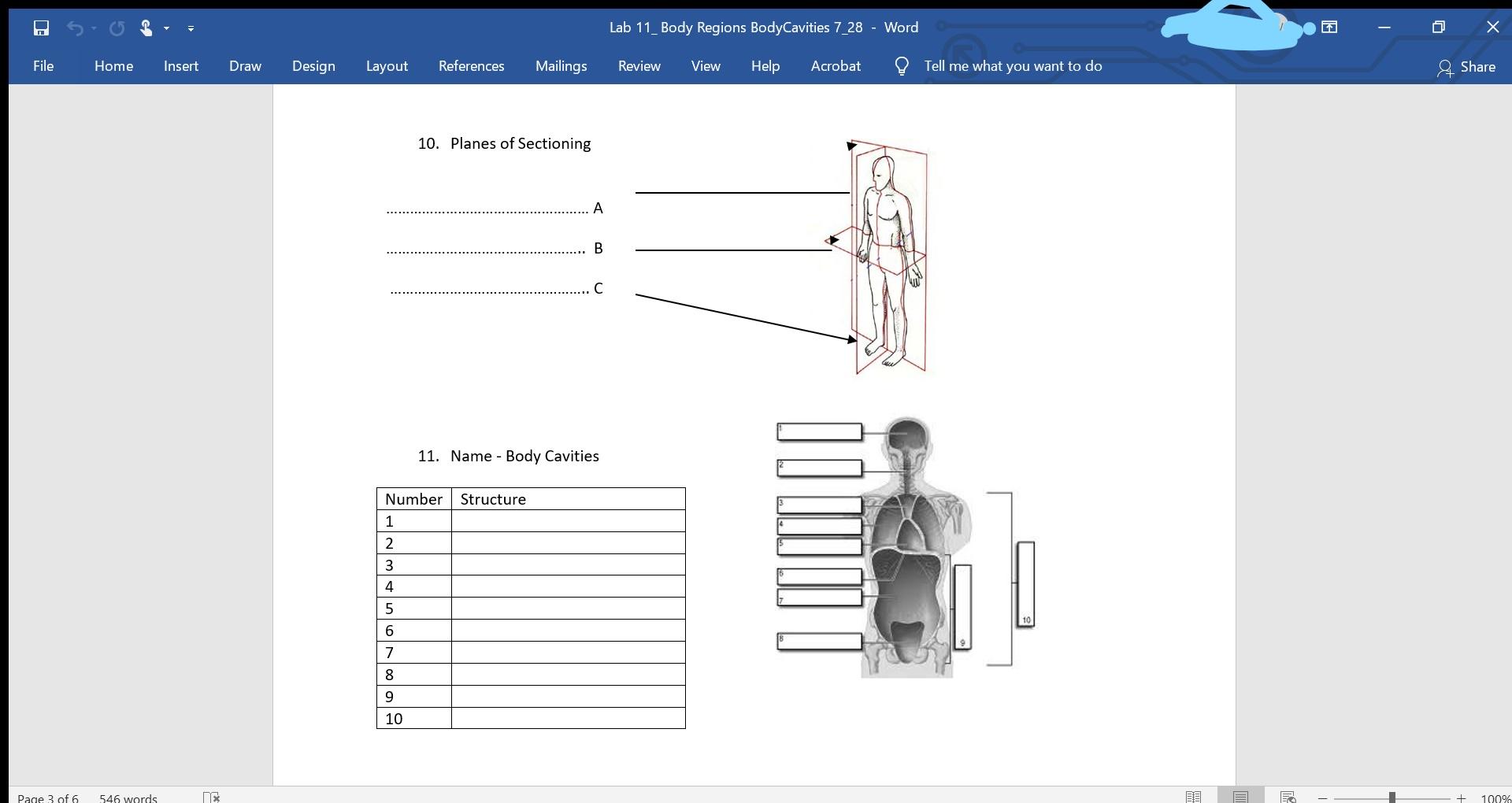 Solved Lab 11_Body Regions BodyCavities 7_28 - Word х File | Chegg.com
